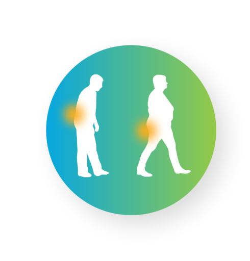 Understanding Lumbar Stenosis with Neurogenic Claudication