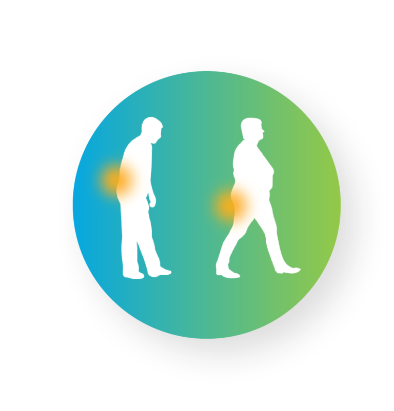 Understanding Lumbar Stenosis with Neurogenic Claudication